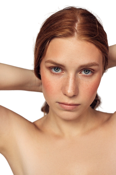 Pigmentation Treatment Perth | Dark Spots & Melasma | COCO